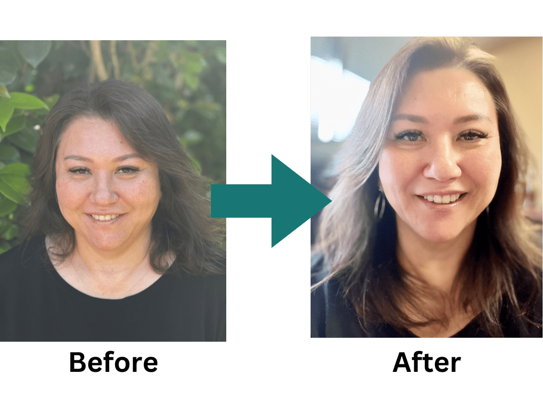 ATTIVA Skin Tightening DRAFT | BioThrive Health